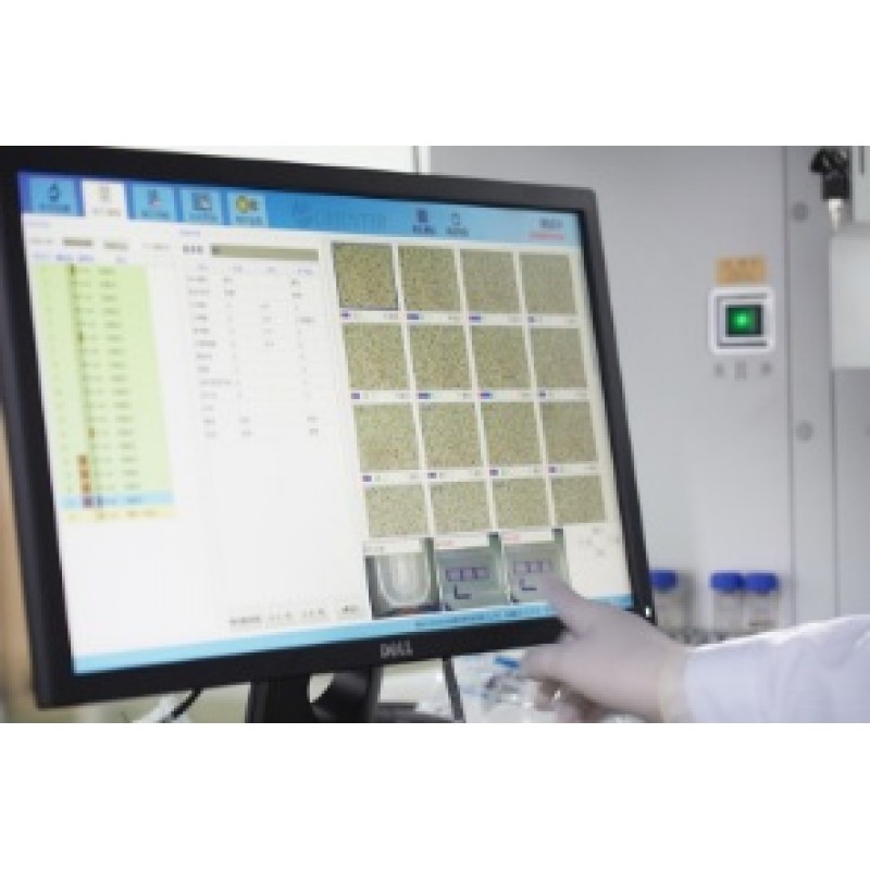 CEmarket/Lab Clinical Equipment Automatic Digital Feces Analyzer/stool ...