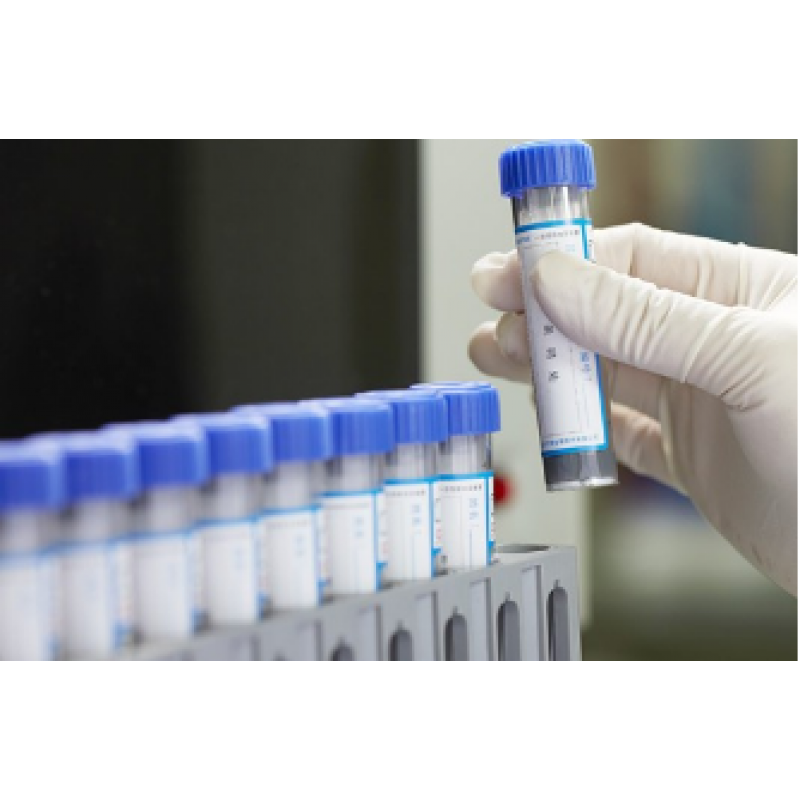 CEmarket/Lab Clinical Equipment Automatic Digital Feces Analyzer/stool ...